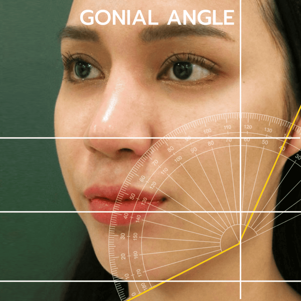 Program Filler Jawline - Infiniz Clinic คลินิกเสริมความงาม