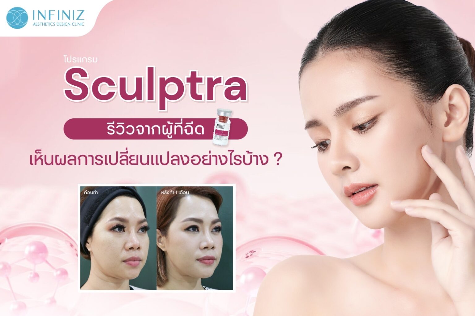 Sculptra รีวิวผลลัพธ์ ก่อน-หลังฉีด เทียบกันแบบชัด ๆ