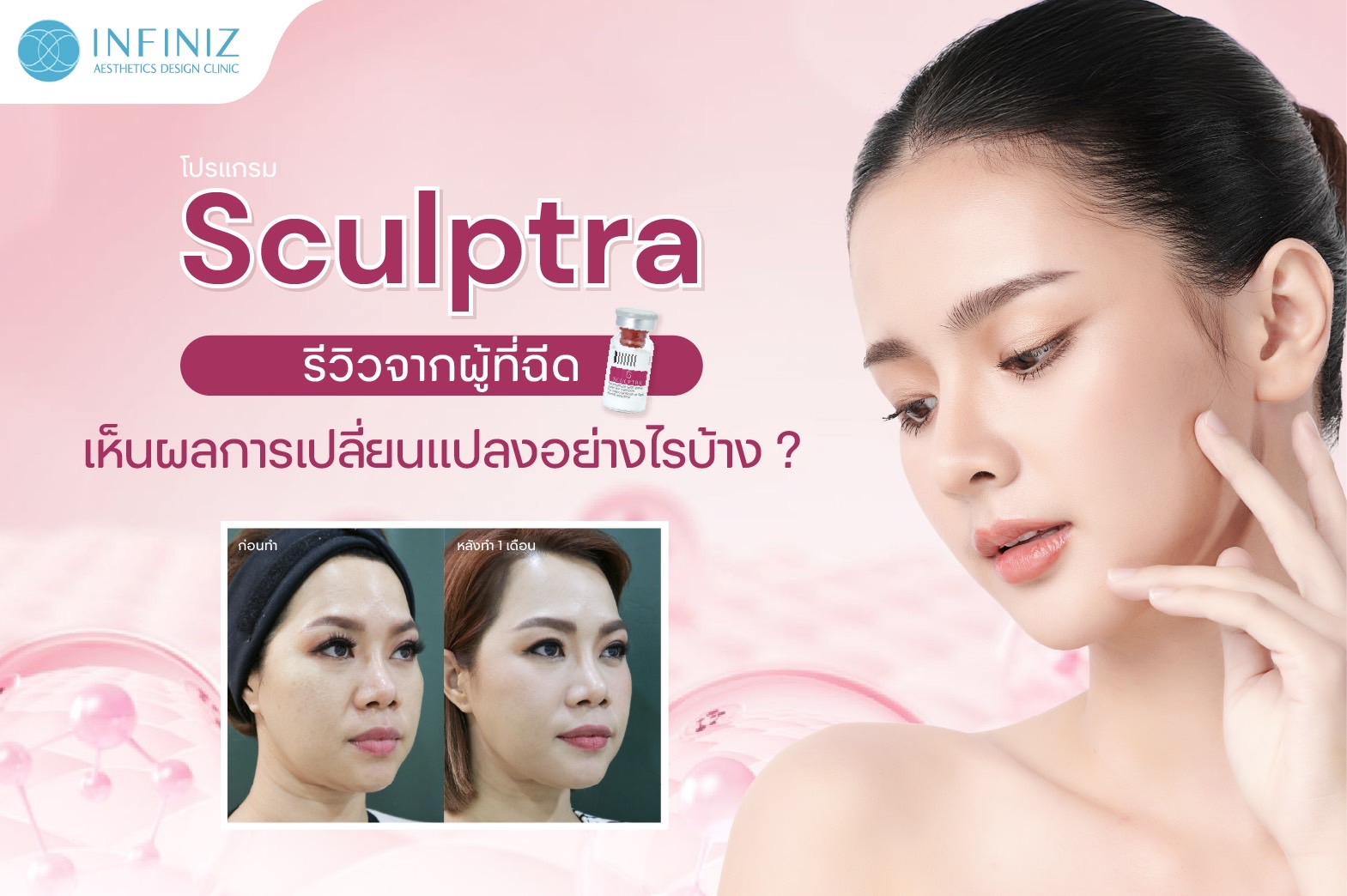 Sculptra รีวิวผลลัพธ์ ก่อน-หลังฉีด เทียบกันแบบชัด ๆ